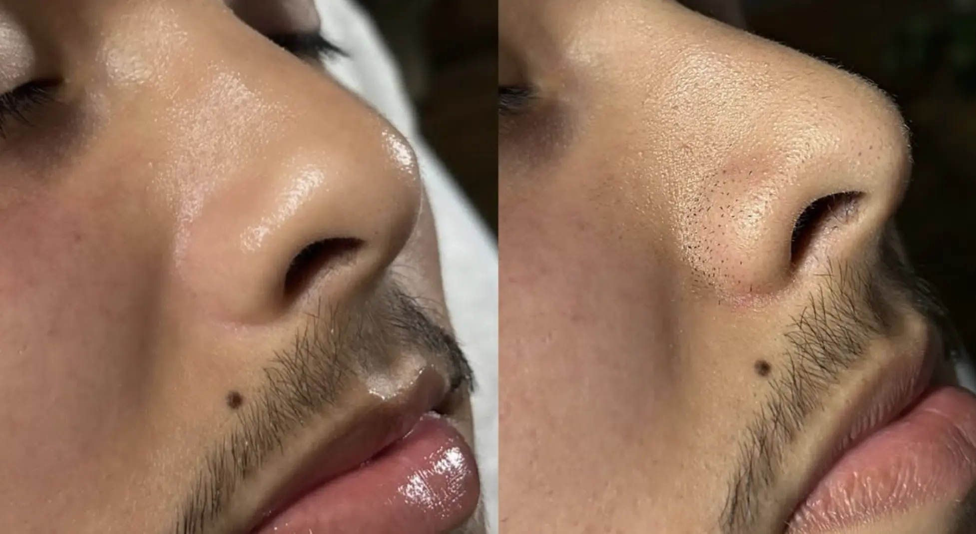 What is a facial?